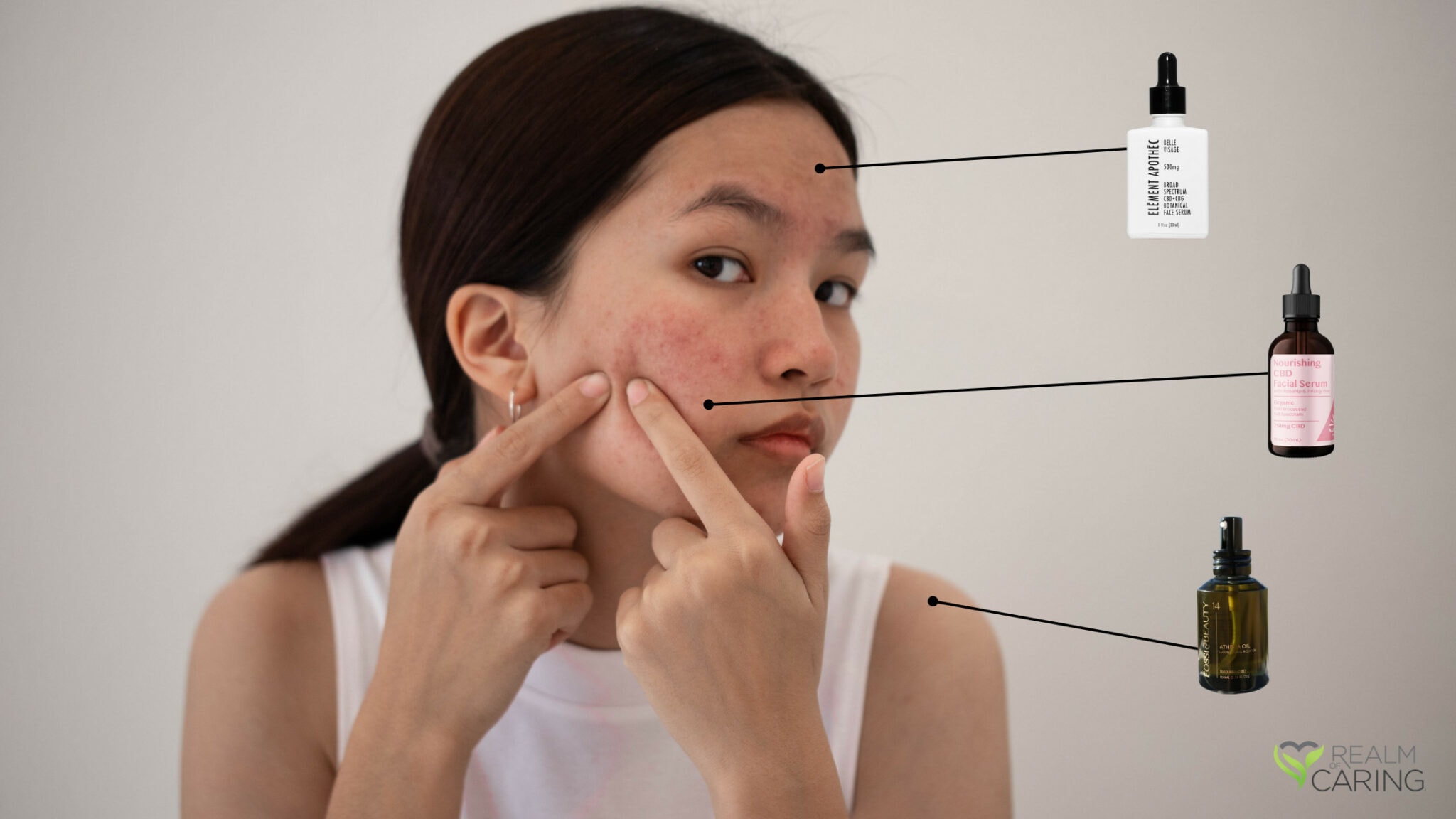 Acne Awareness Month & How Cannabis Can Help Your Acne - Realm of ...